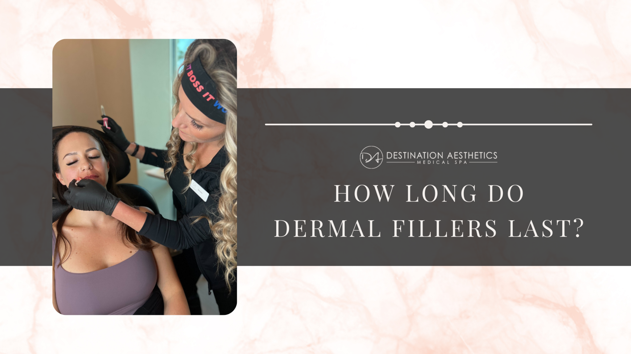 How Long Do Dermal Fillers Last? | Destination Aesthetics Medical Spa